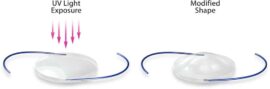 Light Adjustable Lens | Advanced Eye Care, SC
